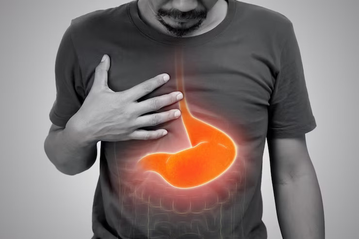 Esophageal Cancer: Causes & Types - Explained