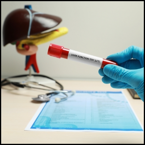 Reading & Interpreting Your Liver Function Test: Healix Hospitals