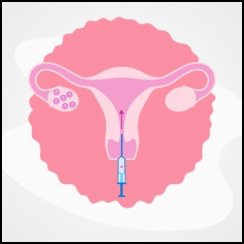 A Patient's Guide to IUI, IVF, and FET | Healix Hospitals